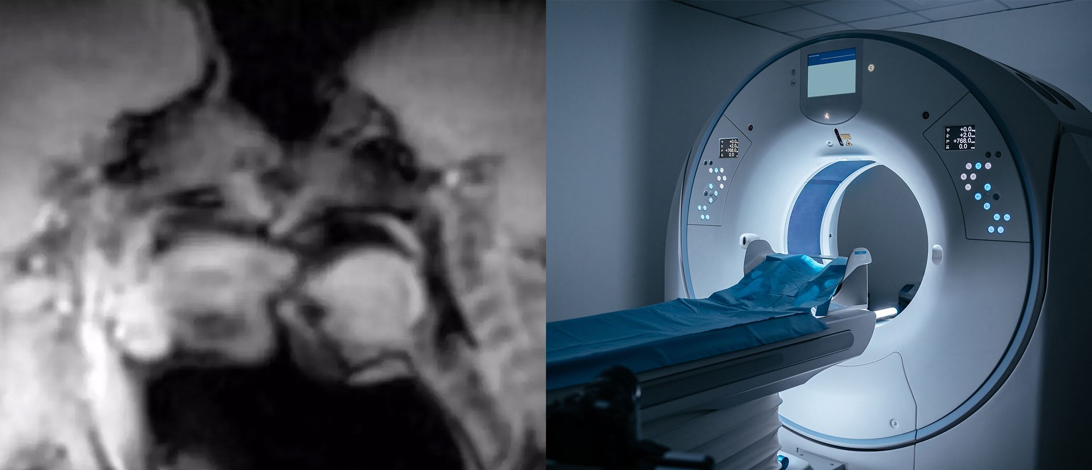 MRI 안에서 성관계를 맺은 남녀